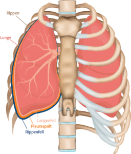 Pleuraerguss / Wasser in der Lunge? Wir helfen!